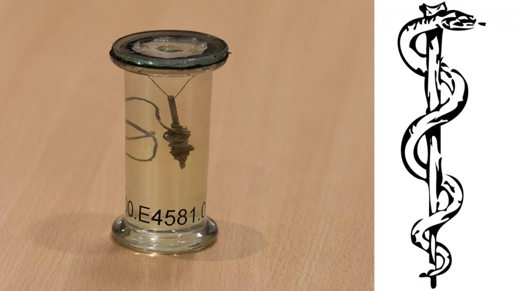 Top treasures at Imperial College London's Pathology Museum