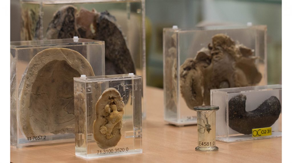 Top treasures at Imperial College London's Pathology Museum