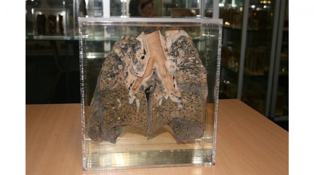 Top treasures at Imperial College London's Pathology Museum