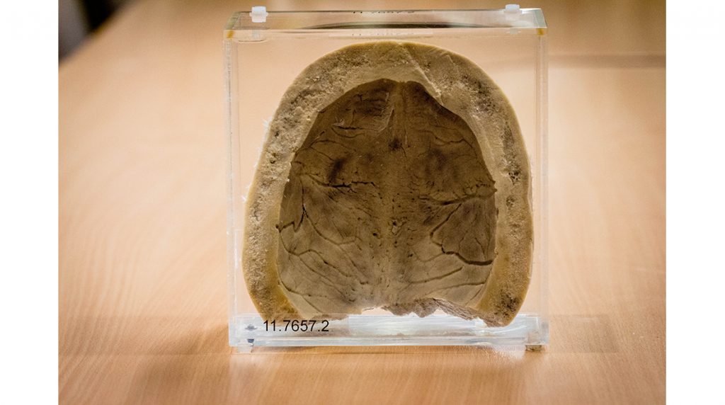 Top treasures at Imperial College London's Pathology Museum