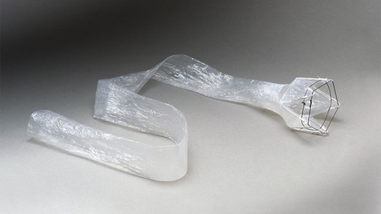 What is the EndoBarrier and how does it help type 2 diabetes?