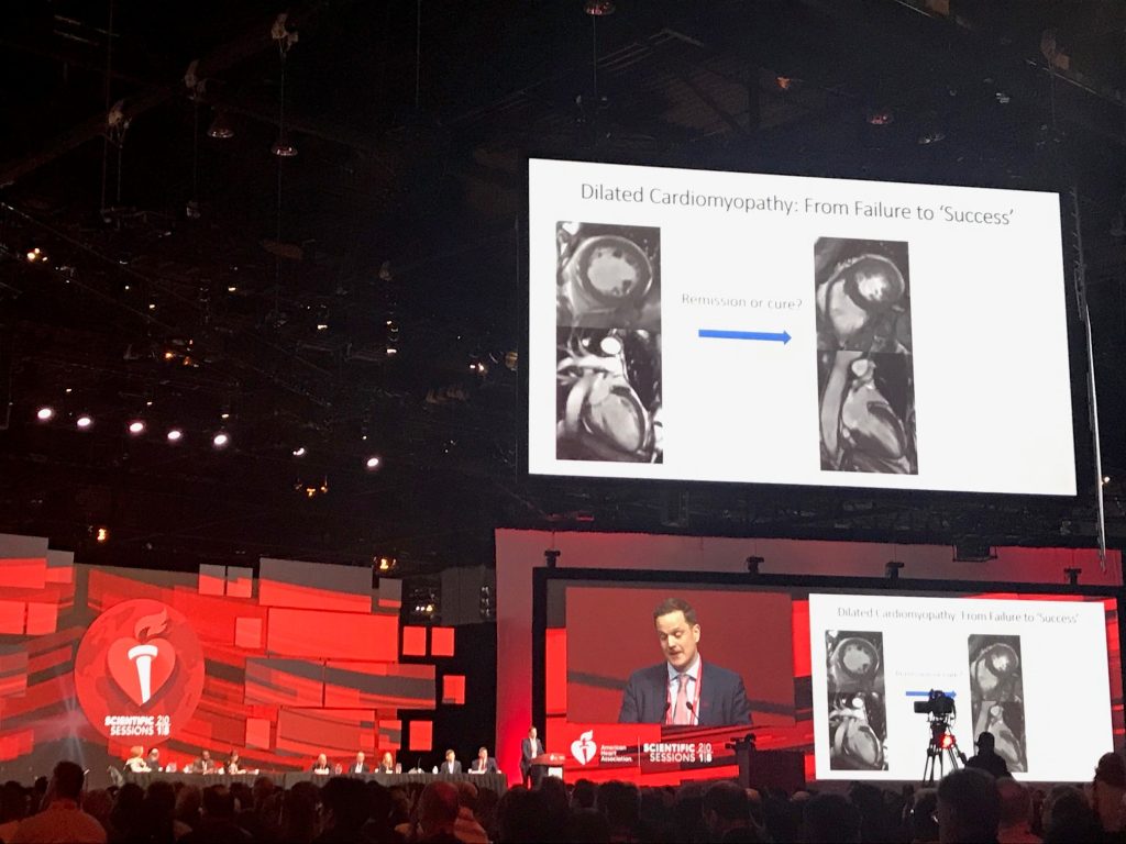 Nurturing hope: Understanding Dilated Cardiomyopathy and transforming ...